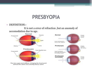 Hypermetropia | PPTX | Eye and Vision Conditions | Diseases and Conditions