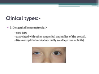 Hypermetropia | PPTX | Eye and Vision Conditions | Diseases and Conditions