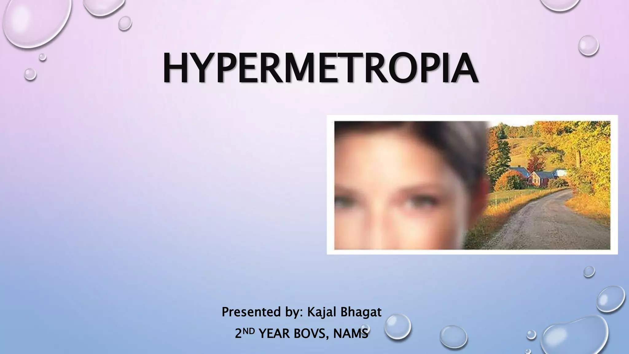 hypermetropia: a refractive error | PPTX
