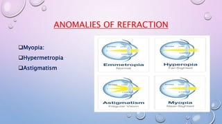 hypermetropia: a refractive error | PPTX