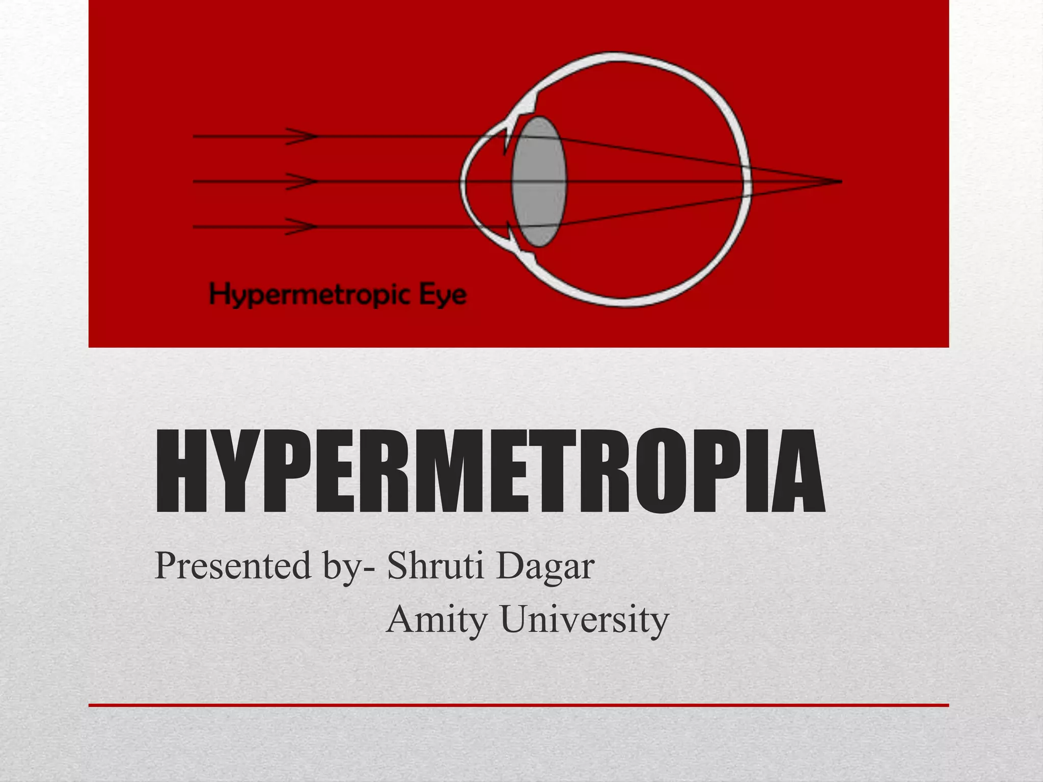 Hypermetropia | PPTX | Eye and Vision Conditions | Diseases and Conditions