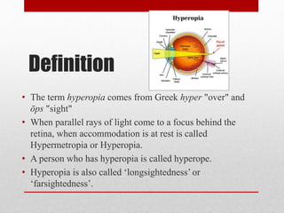 Hypermetropia | PPTX