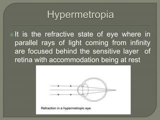 Hypermetropia.pptx
