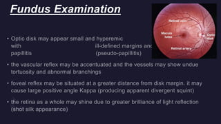 HYPERMETROPIA , basics of hypermetropia. | PPT
