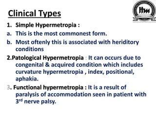 Hypermetropia | PPTX