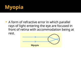 Hypermetropia, Myopia refractive errors.pptx