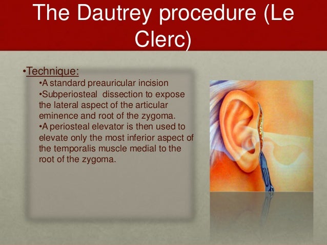 Hypermobility and ankylosis