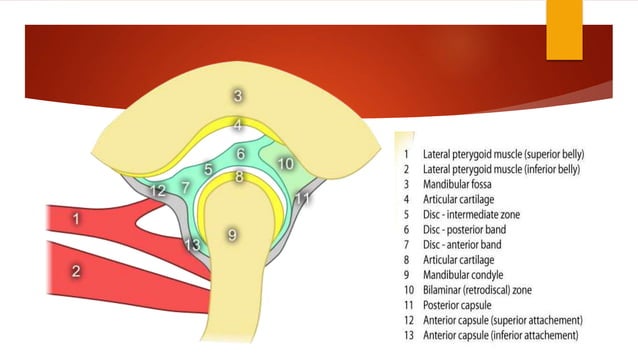 Hypermobility of TMJ | PPTX | Death, Injury, or Military Conflict ...