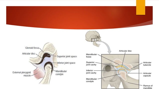 Hypermobility of TMJ | PPTX | Death, Injury, or Military Conflict ...
