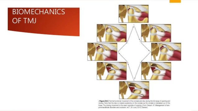 Hypermobility of TMJ