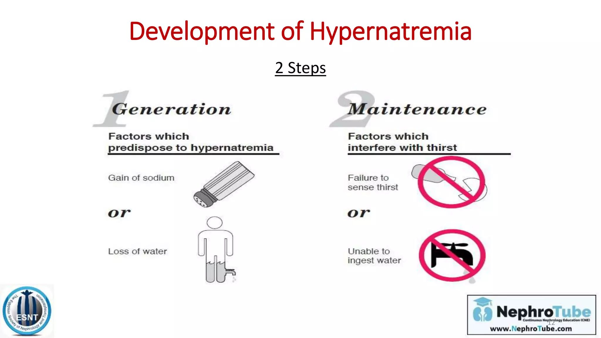 Hypernatremia - Stepwise Practical Approach - Dr. Gawad | PPTX