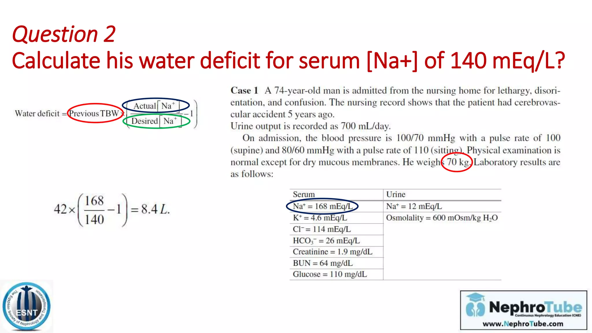 Hypernatremia - Stepwise Practical Approach - Dr. Gawad | PPTX