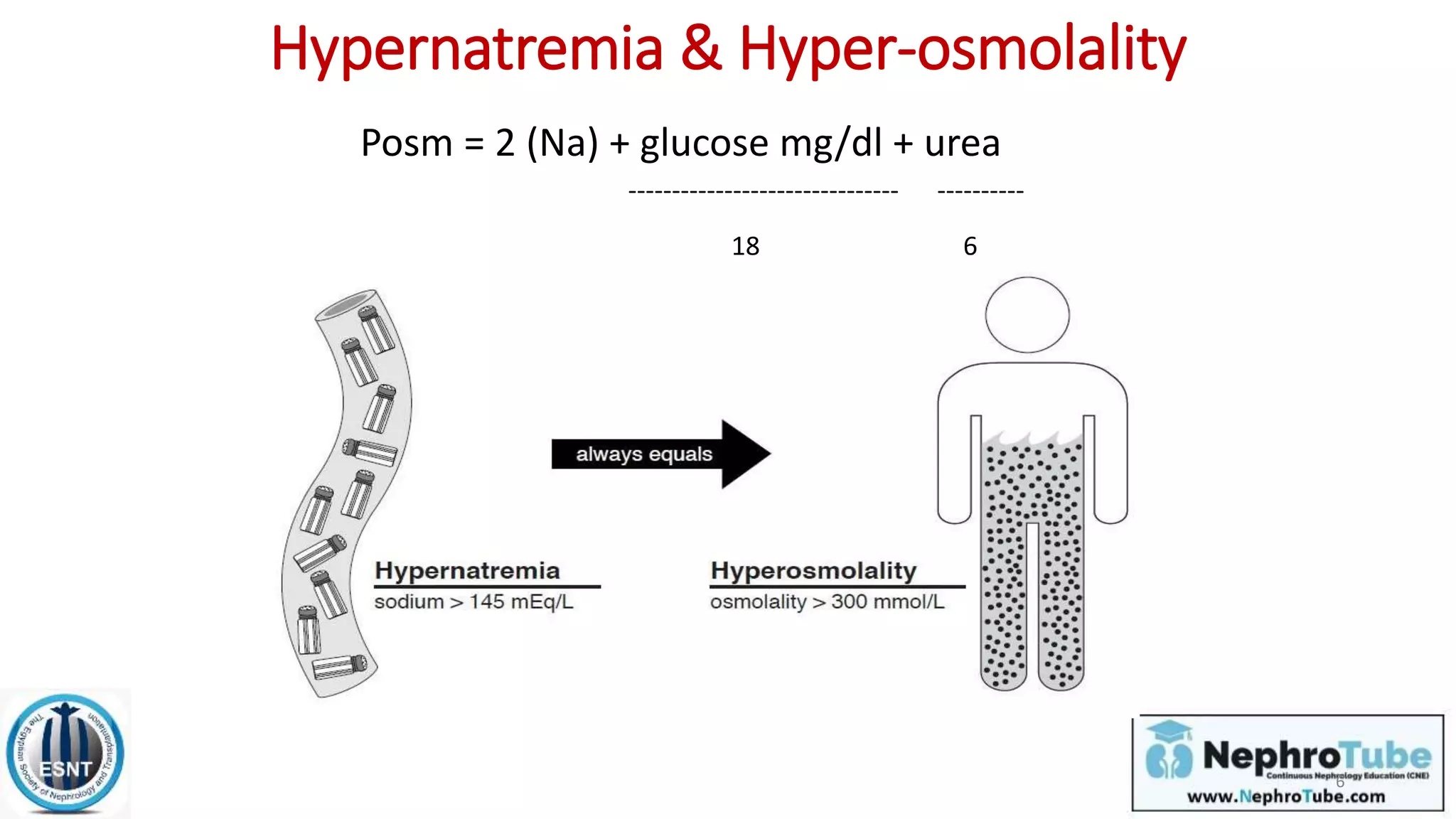 Hypernatremia - Stepwise Practical Approach - Dr. Gawad | PPTX