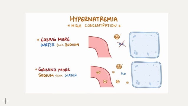 Hypernatremia in elderly patients | PPTX | Blood Disorders | Diseases ...