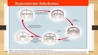 HYPERNATREMIC DEHYDRATION.pptxccjffjfjfjfjcff | PPT
