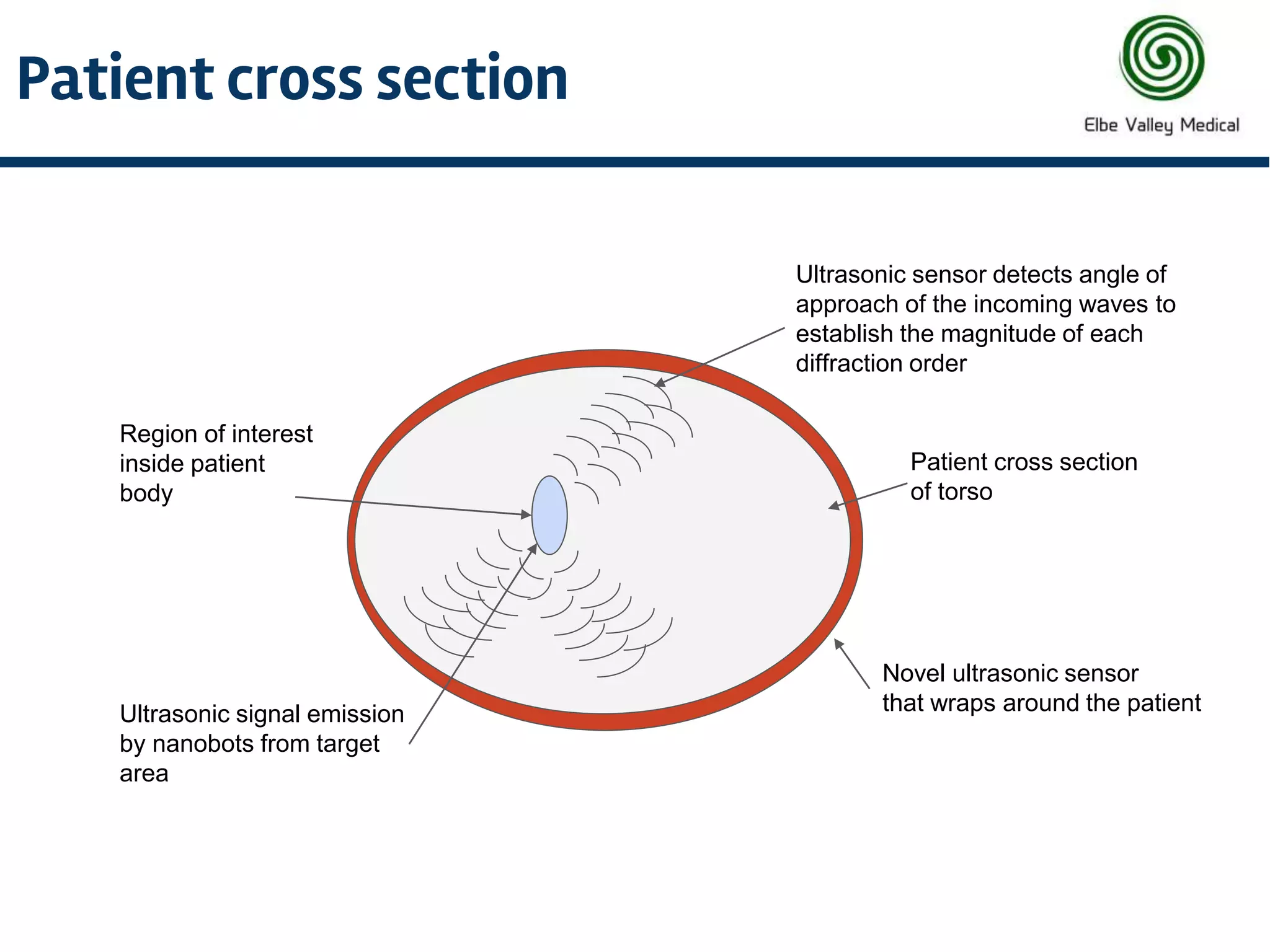 Hyper NA ultrasonic imaging system | PPTX