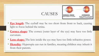 HYPEROPIA/FARSIGHTEDNESS in children.pptx
