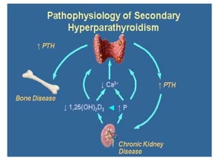 Hyperparathyroidism | PPTX