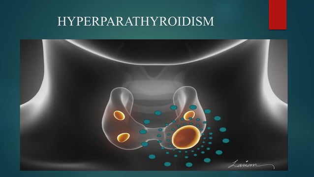 HYPERPARATHYROIDISM & HYPOPARATHYROIDISM.pptx