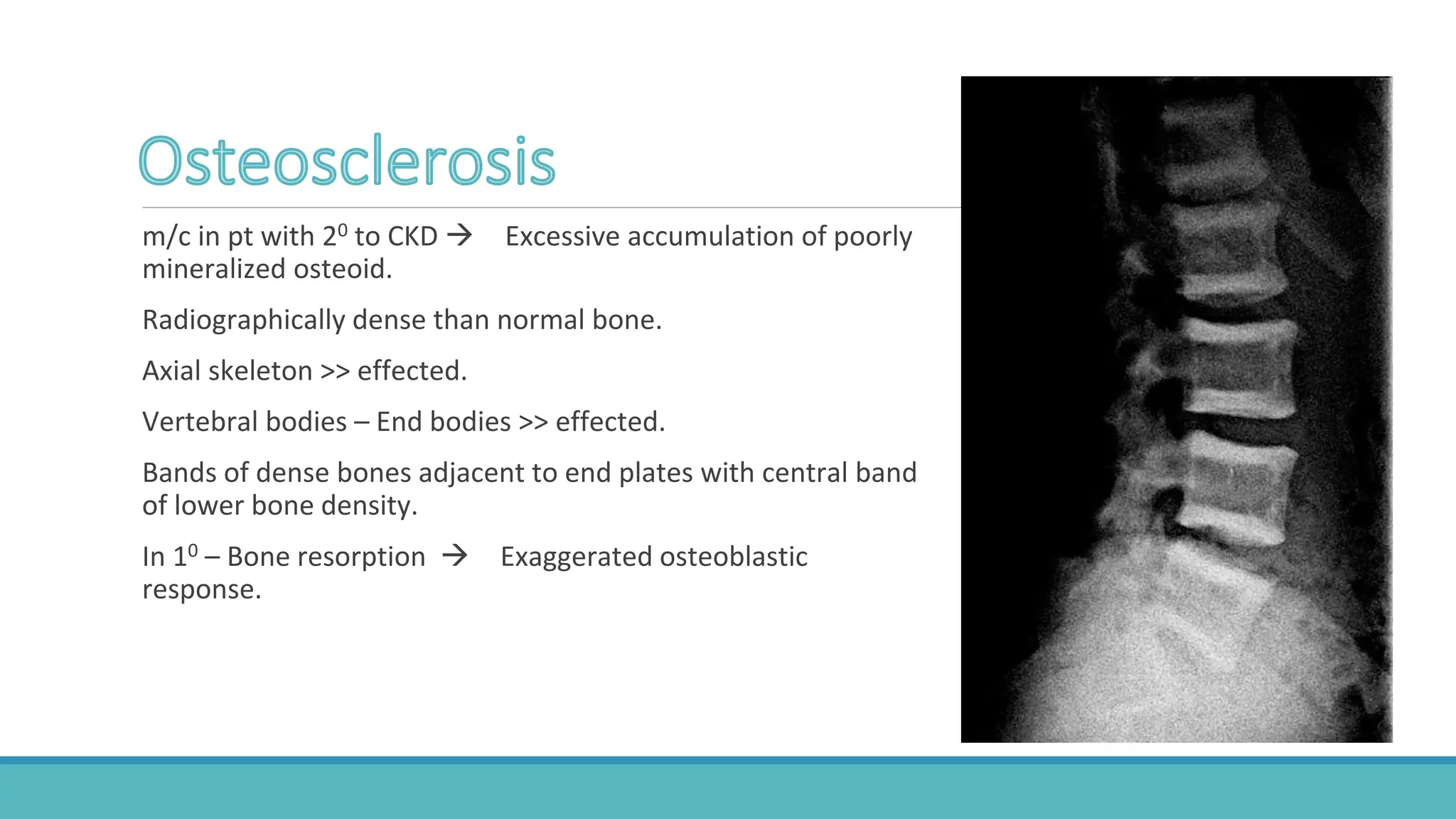 hyperparathyroidism imaging metabolic bone disease.pptx