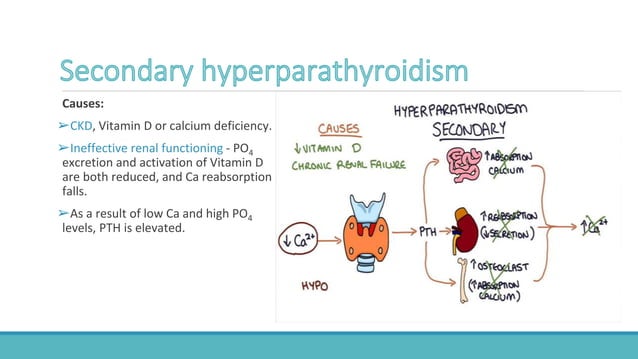 hyperparathyroidism imaging metabolic bone disease.pptx