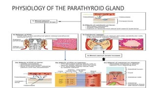HYPERPARATHYROIDSM.pptx