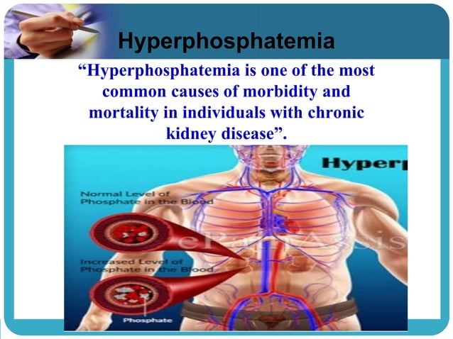 Hyperphosphatemia | PPTX | Nutrition | Healthy Living