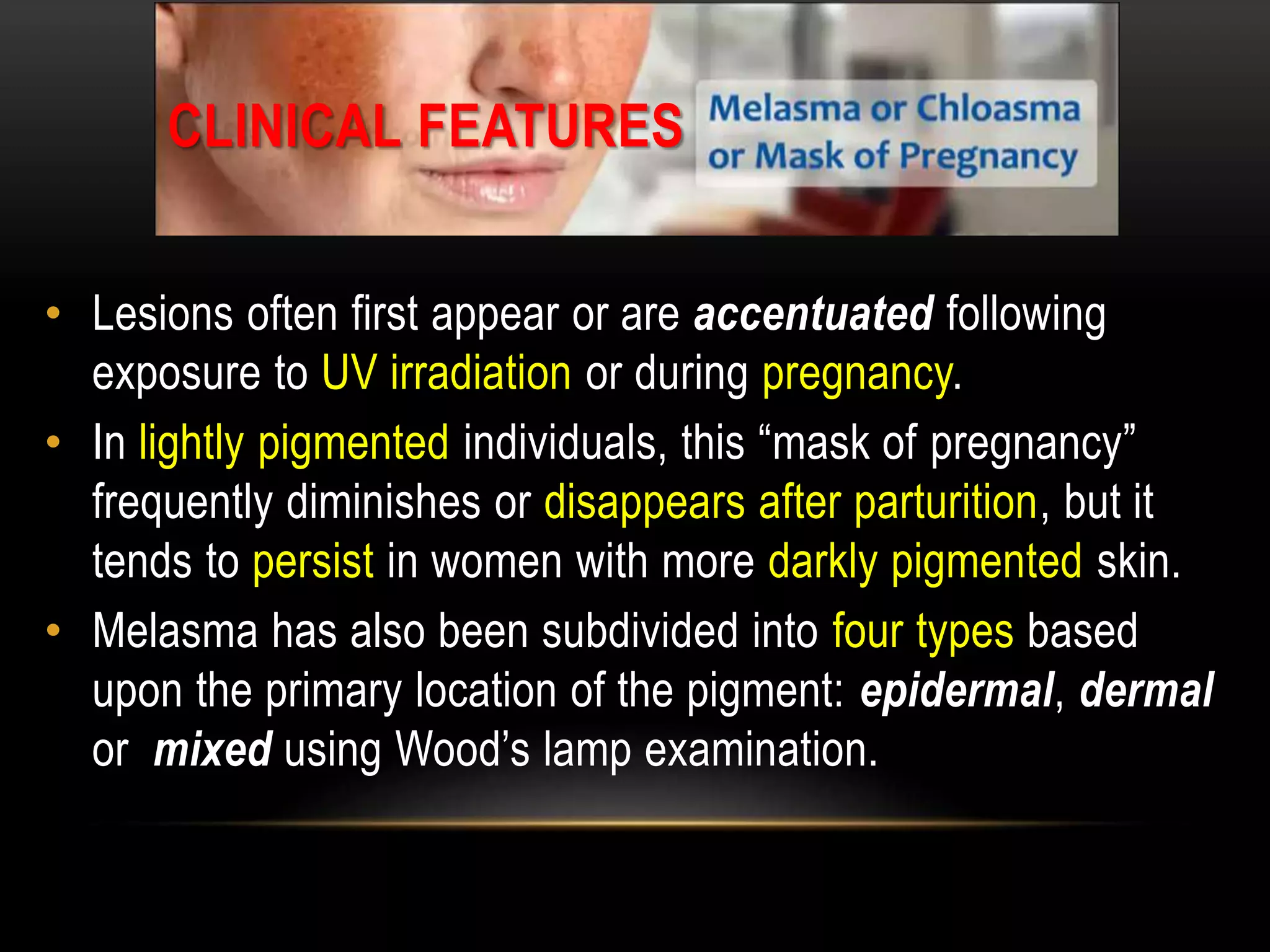 Disorders of Hyperpigmentation | PPTX