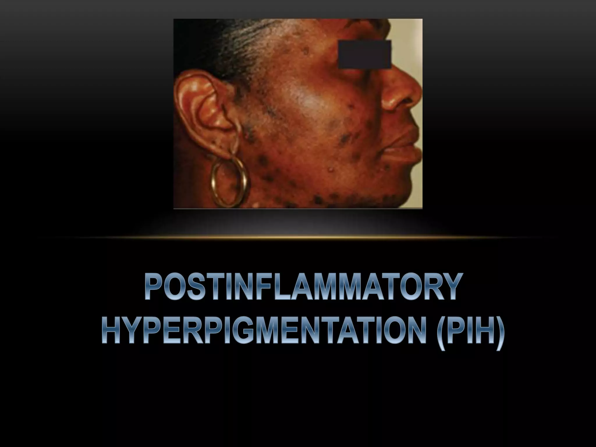Disorders of Hyperpigmentation | PPTX
