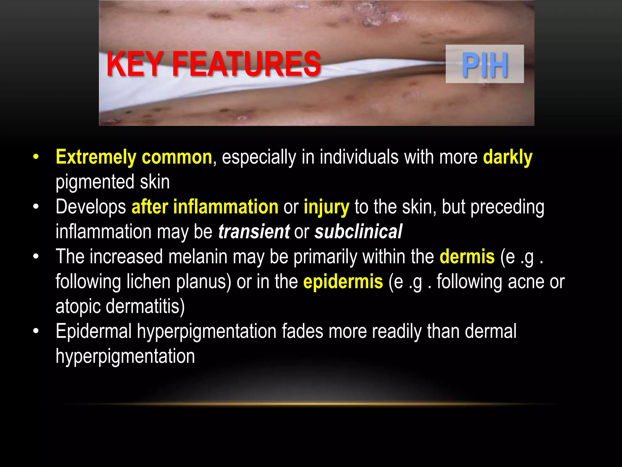 Disorders of Hyperpigmentation | PPTX