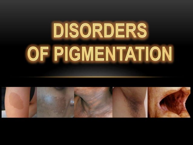 Disorders of Hyperpigmentation | PPTX | Skin and Dermatology | Diseases ...