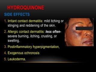 Disorders of Hyperpigmentation | PPTX