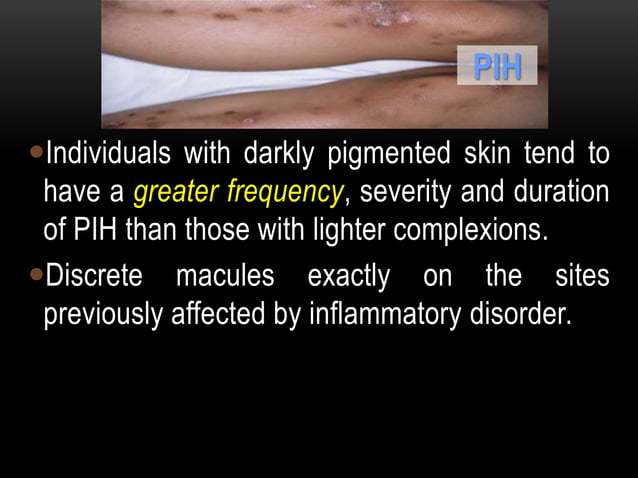 Disorders of Hyperpigmentation | PPTX | Skin and Dermatology | Diseases ...