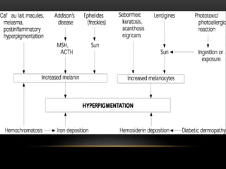 Disorders of Hyperpigmentation | PPTX