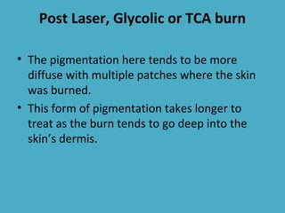 Hyperpigmentation on the face slide share | PPT