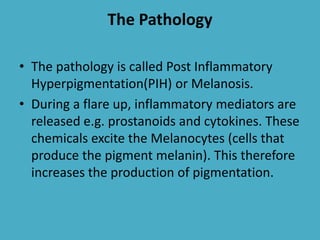 Hyperpigmentation post eczema | PPTX