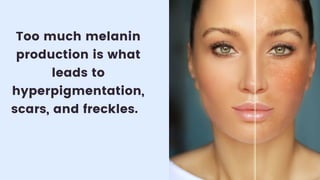 What Is Hyperpigmentation? | PDF