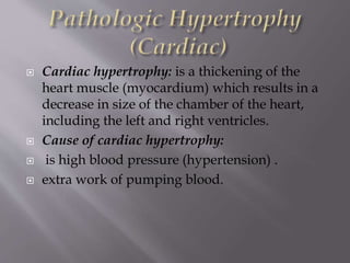 Hyperplasia | PPTX