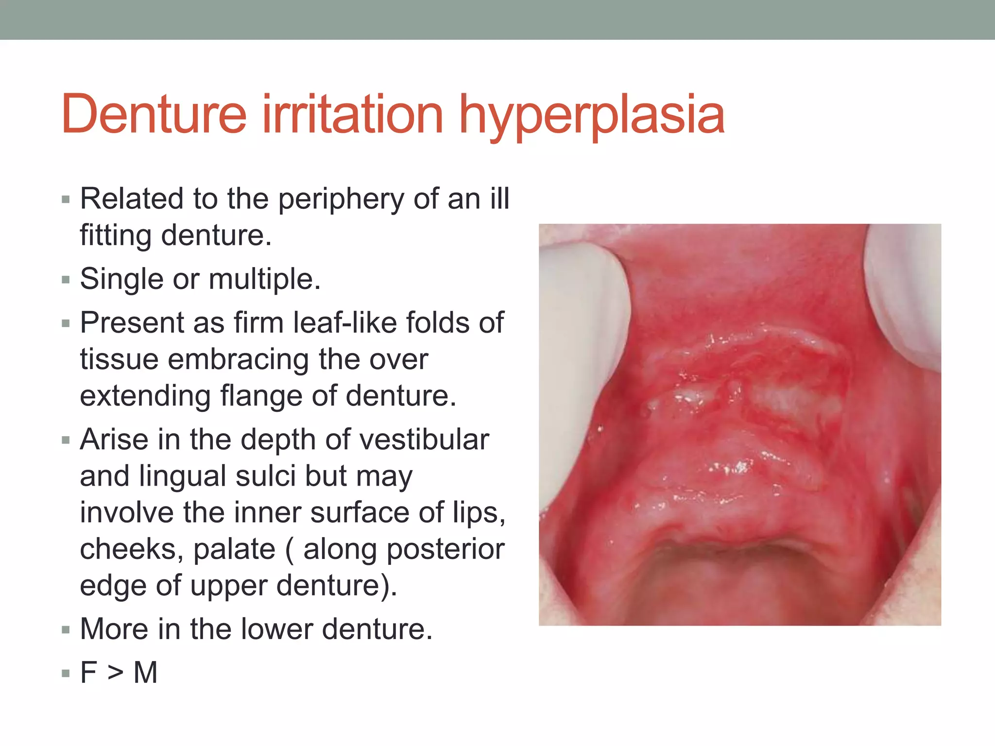 Hyperplasia | PPTX