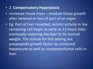 Hyperplasia | PPTX