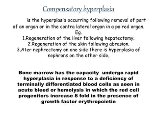 Hyperplasia | PPT