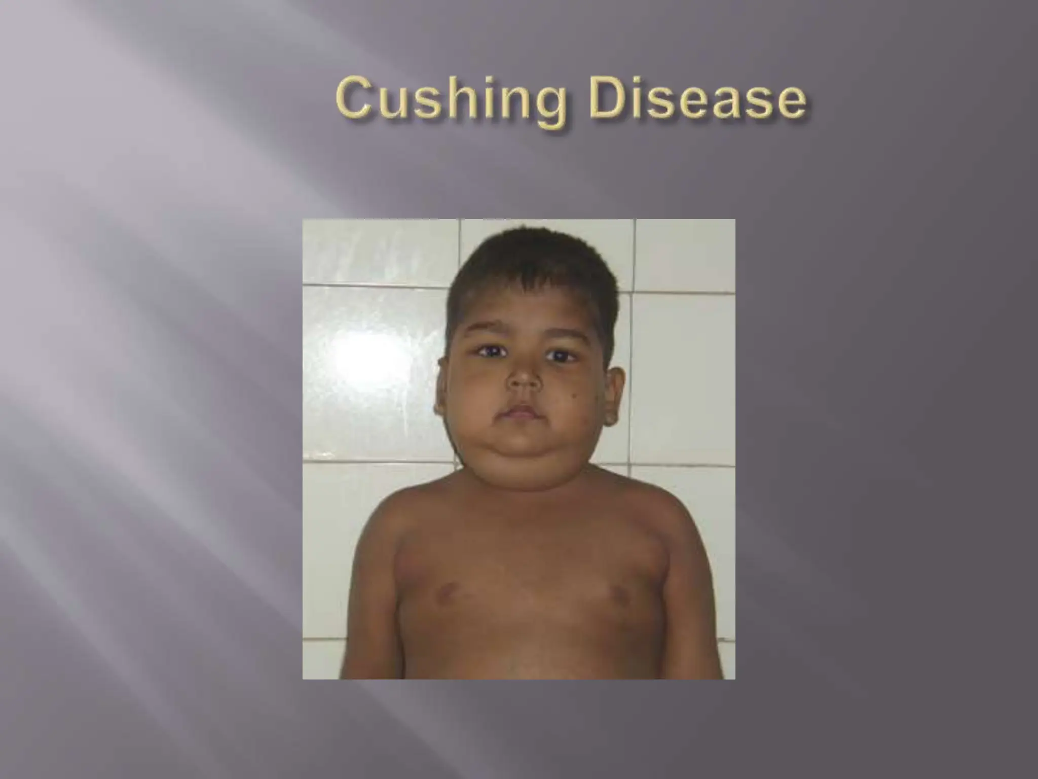 Hyperplasia Pathology By Talha Shahid Pptx