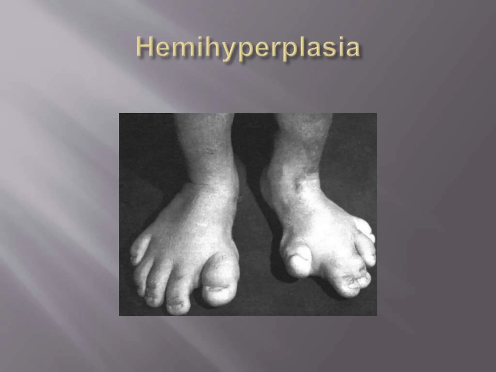 hyperplasia PATHOLOGY BY TALHA SHAHID.pptx