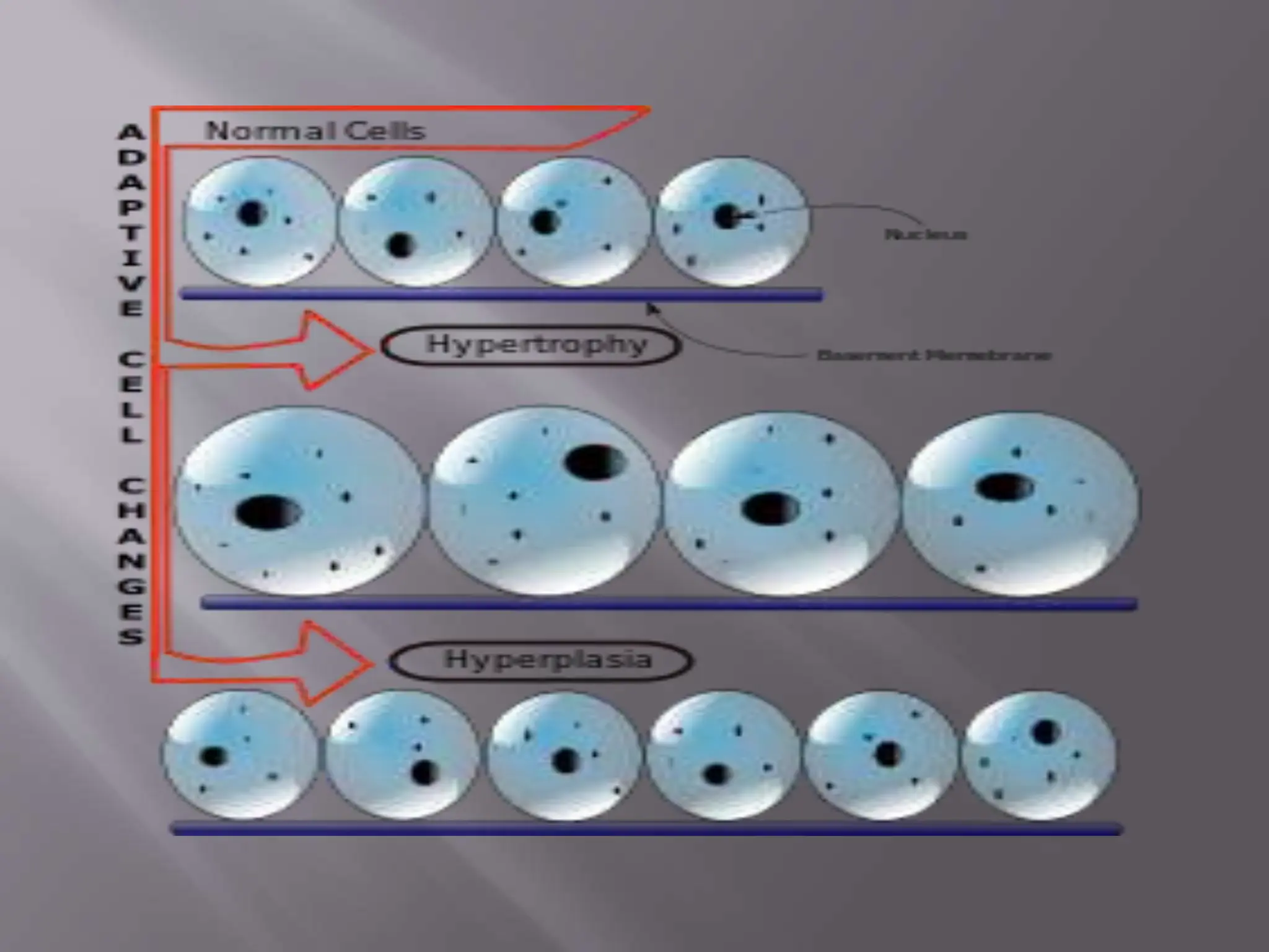 hyperplasia PATHOLOGY BY TALHA SHAHID.pptx