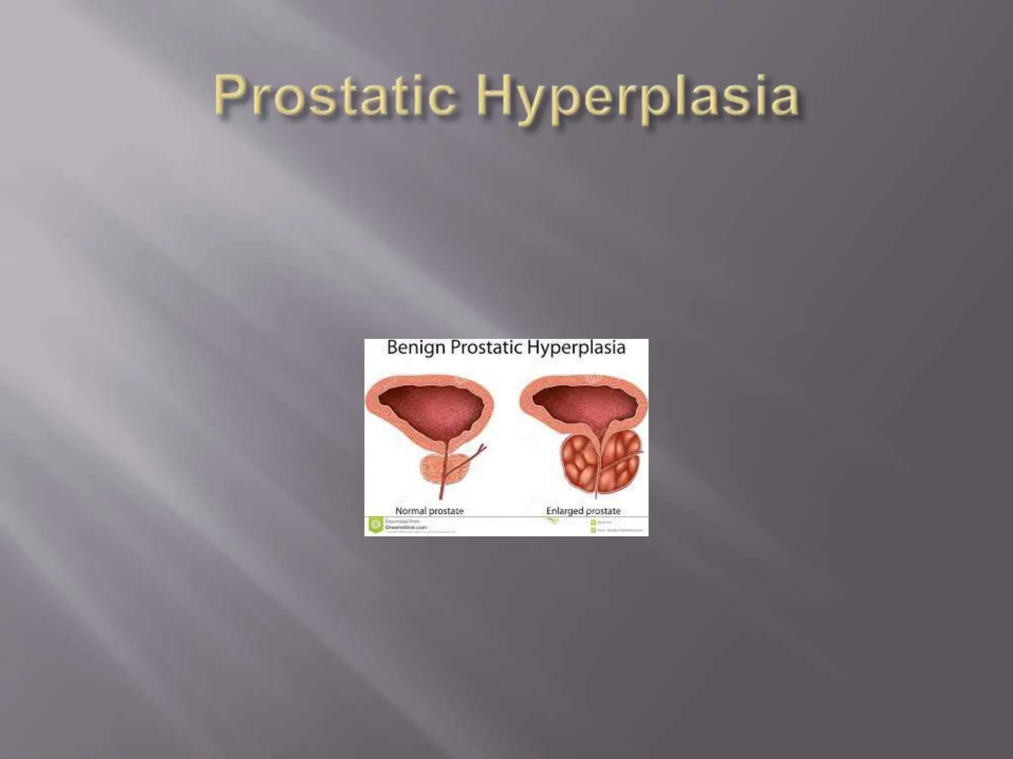 Hyperplasia Pathology By Talha Shahid Pptx