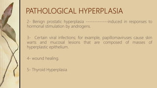 Hyperplasia (1) | PPTX