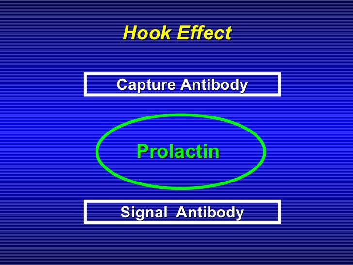 Hyperprolactinemia 3