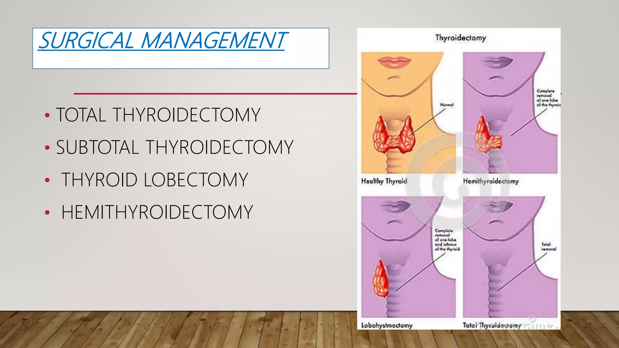 Hyperthyroidism - clinical features, cause, management, surgery | PPTX