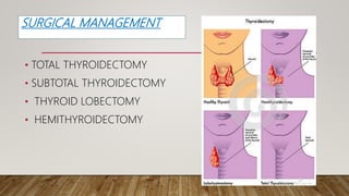 Hyperthyroidism - clinical features, cause, management, surgery | PPT