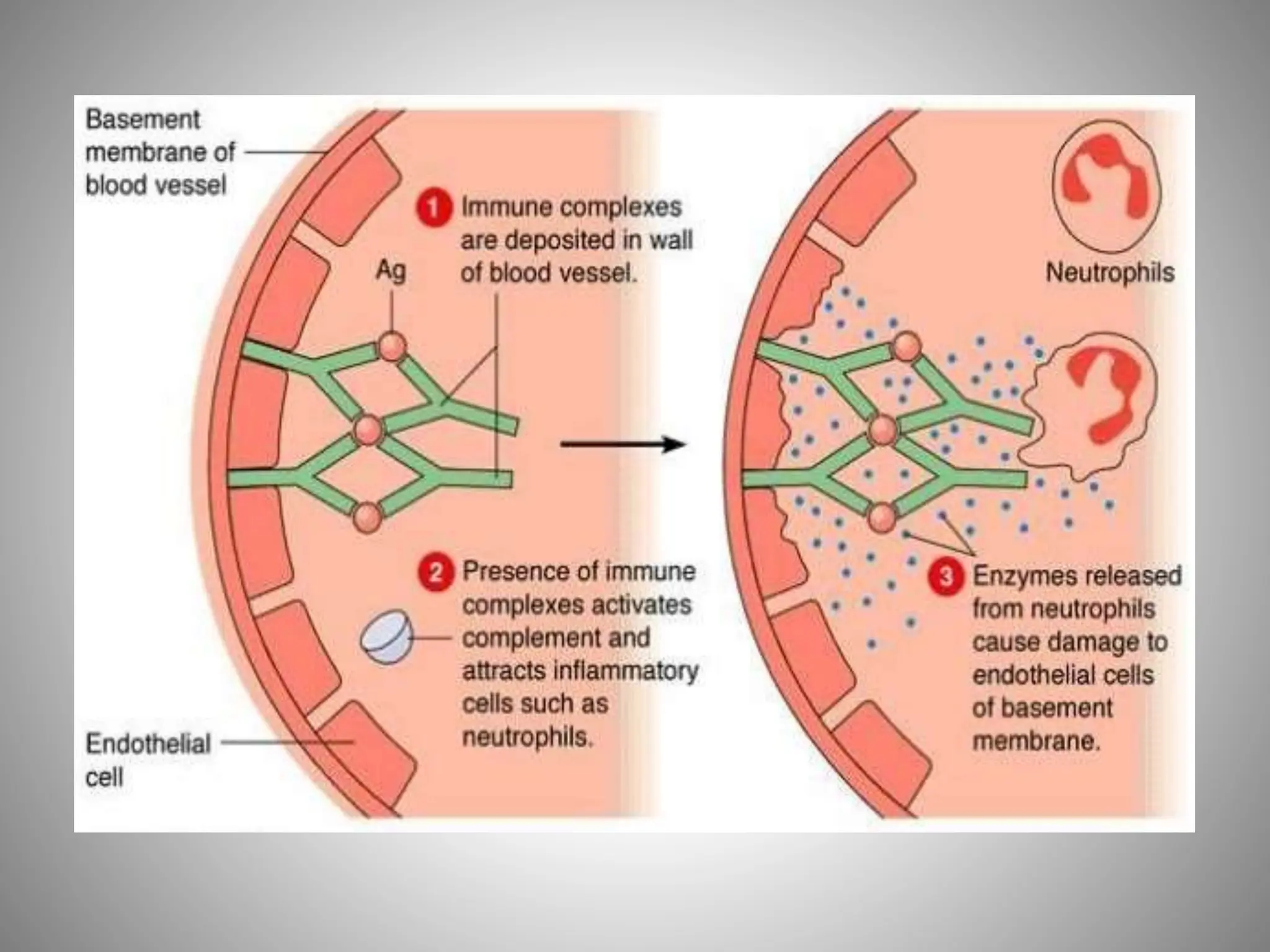 MECHANISMS OF DIFFERENT TYPES OF HYPERSENSITIVITY REACTIONS.pptx